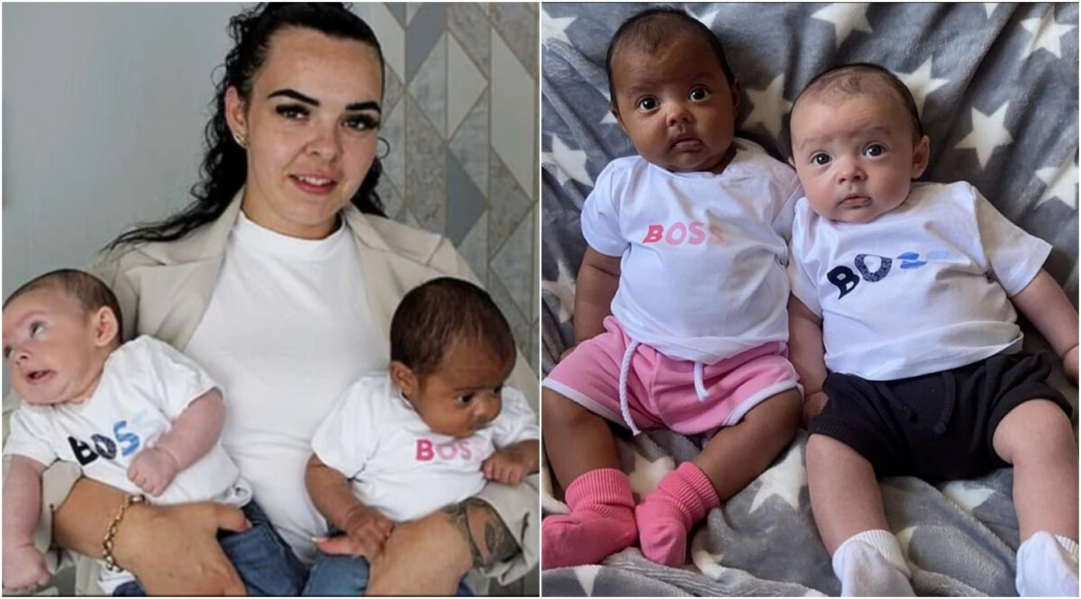 PHOTO+VIDEO | One in a million cases: UK twins born with different skin ...