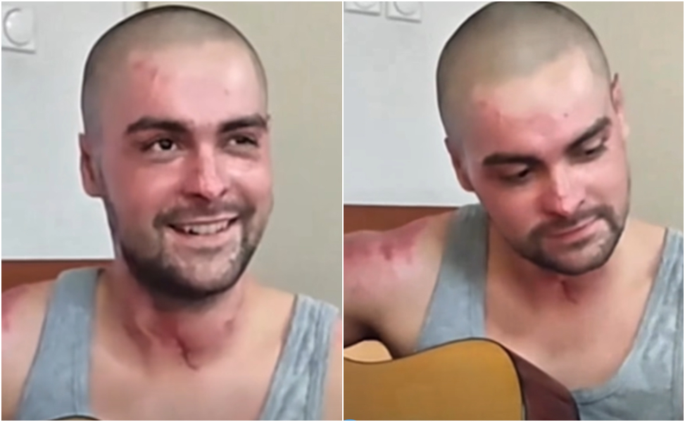 ВИДЕО | Тешко повредениот гитарист на „ДНК“ повторно запеа ...